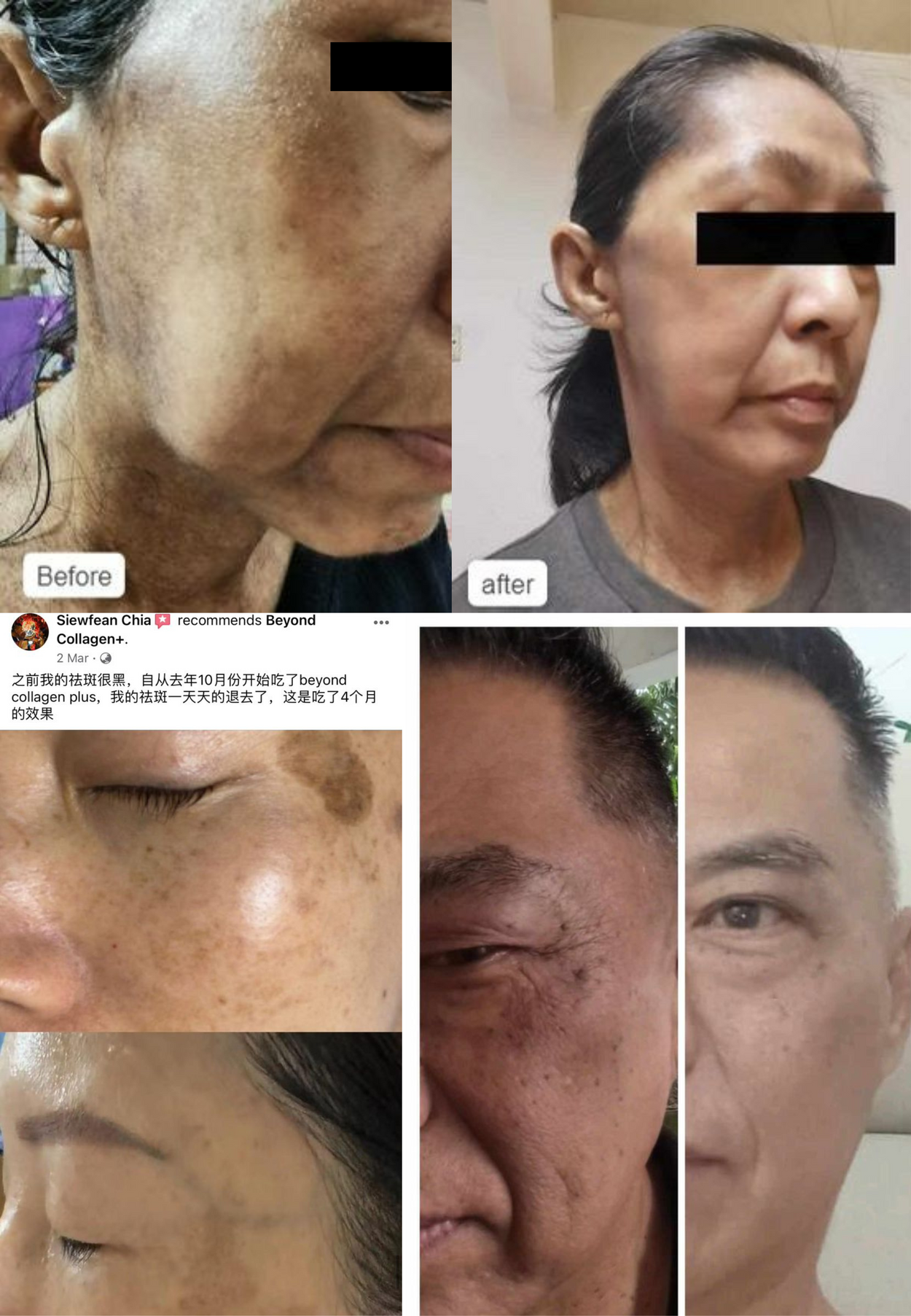 Collagen Supplements vs. Aesthetic: Comparing Approaches to Skin Healt ...